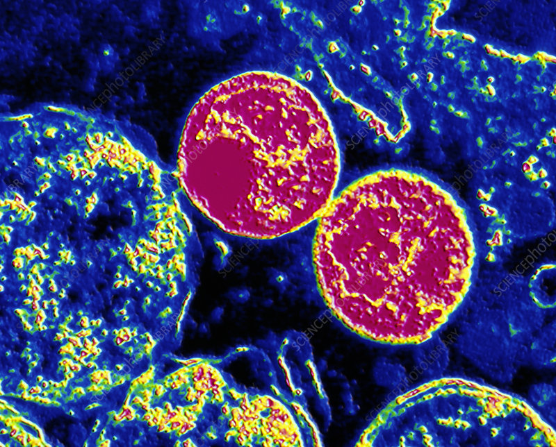 LGV Lymphogranuloma Venereum Treatment in Hong Kong | PrEPAsian - I ...